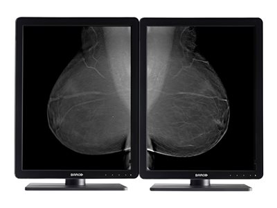 Barco Nio 5MP MDNG-5221 - LED monitor - 2 x 5MP - grayscale - 21.3 ...