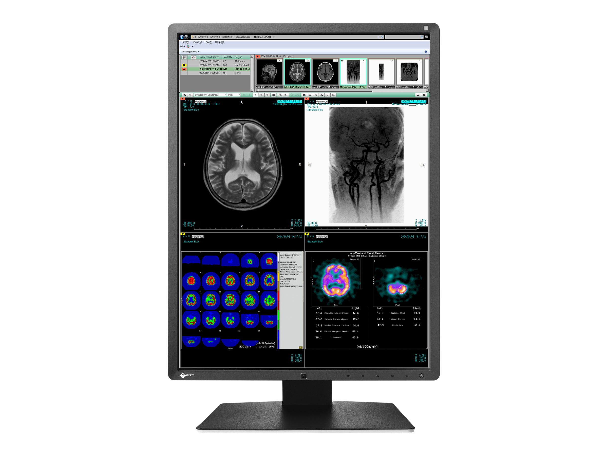 EIZO RadiForce RX350 Dual Head | Overview, Specs, Details | SHI