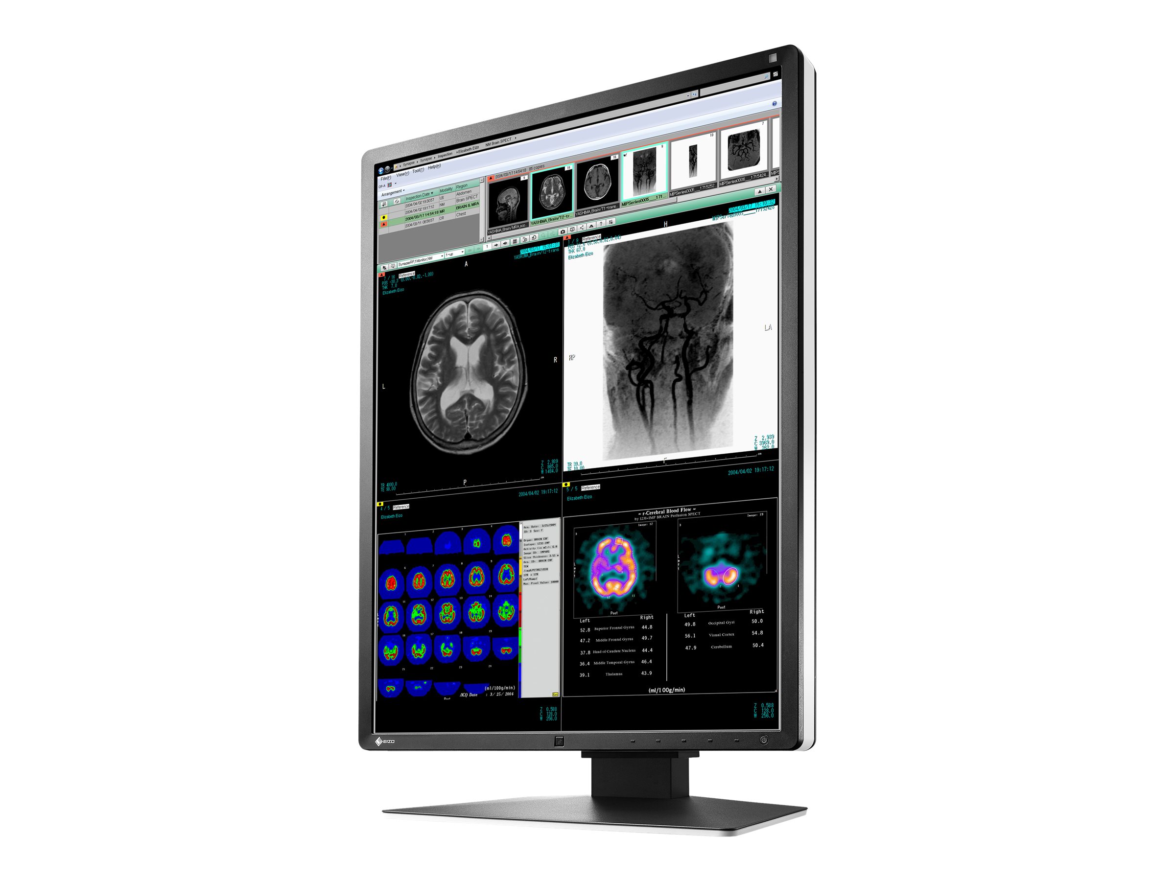 EIZO RadiForce RX350 Dual Head | Overview, Specs, Details | SHI