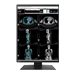 EIZO RadiForce RX370 - LED monitor - 3MP - color - 21.3"