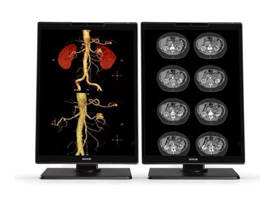 Barco Nio C 3MP-2H MXRT-6700: two MDNC-3521 Color Diagnostic Displays ...